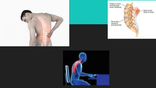 (BACK PAIN) (1).pptx