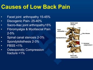 Back pain guide line | PPTX