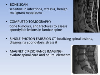 Back pain in children | PPTX