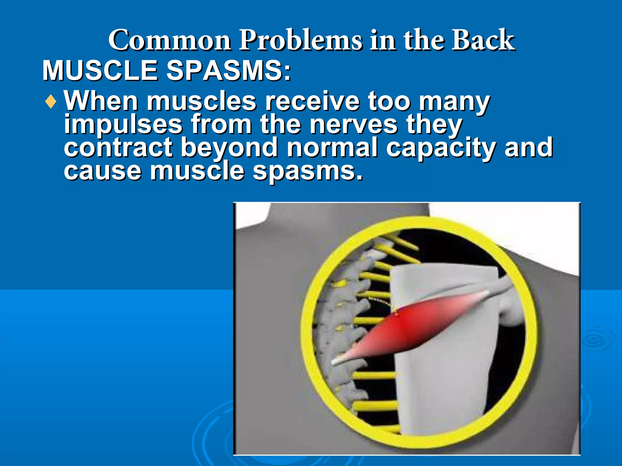 Back Safety and Lifting | PPT