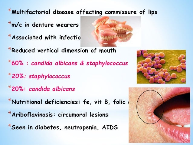 bacterial infections and their oral manifestations