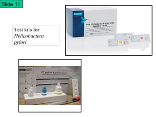 Bacteria helicobacter pylori - ulcers | PPT | Digestive Disorders ...