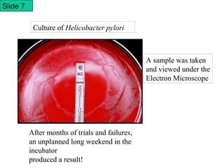 Helicobacter Pylori Culture