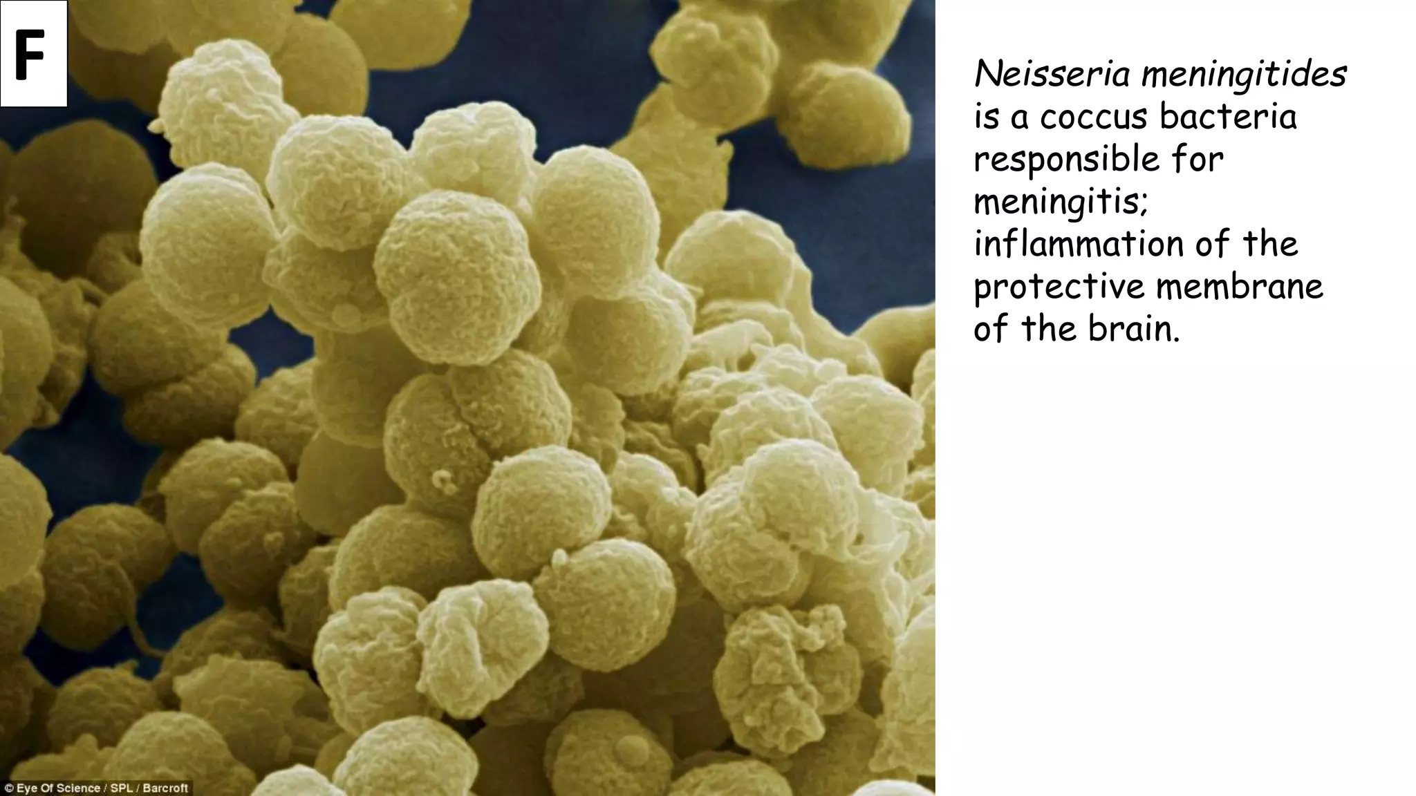 Bacteria Disease Examples | PPTX