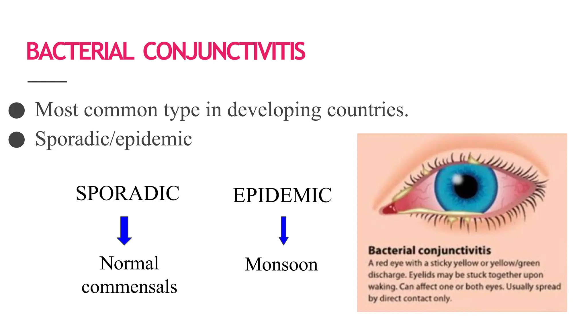 Conjuctiva bacterial eye type of conjunctivitis .pptx