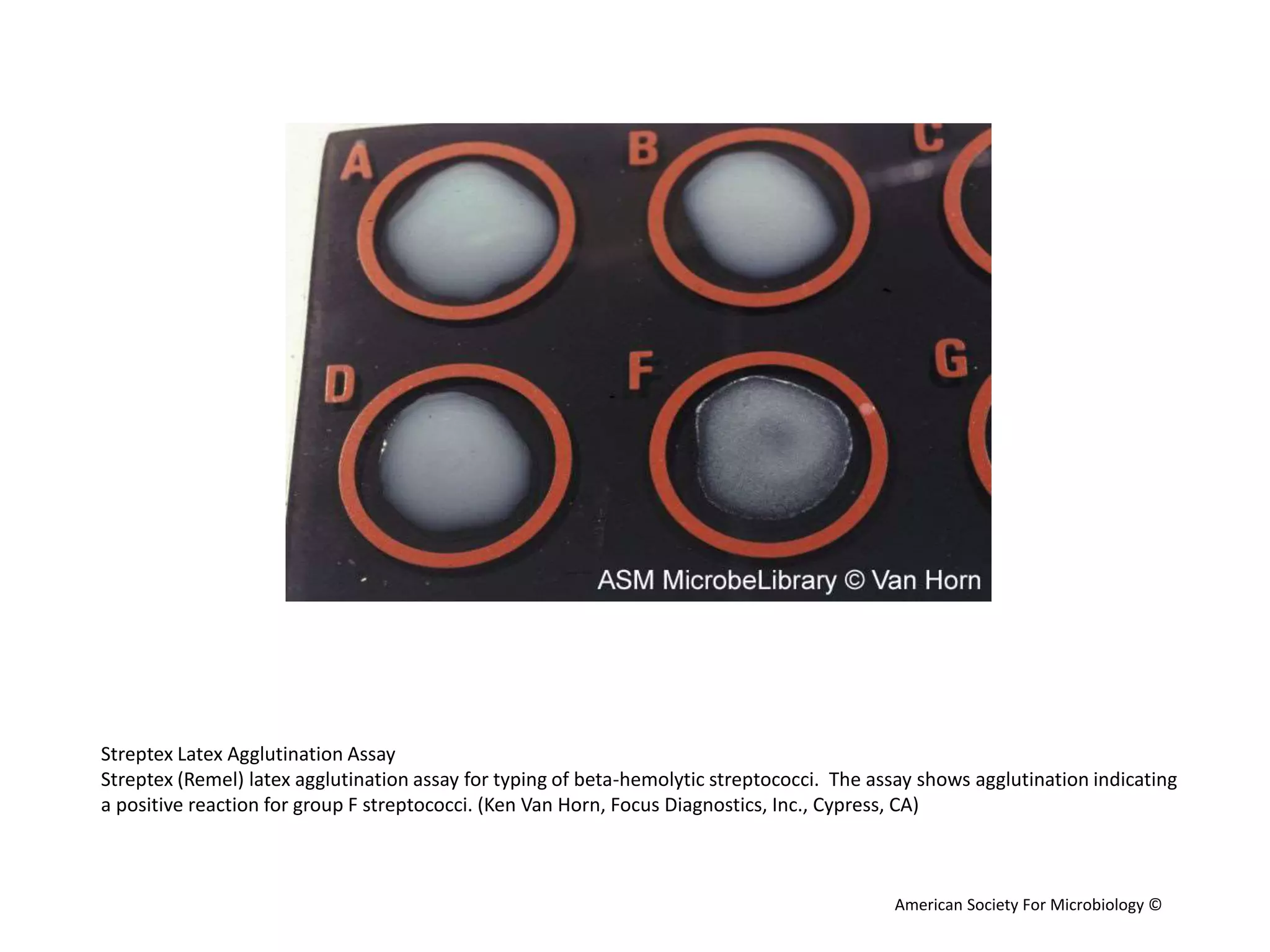 BACTERIAL-AGGLUTINATION.pptx