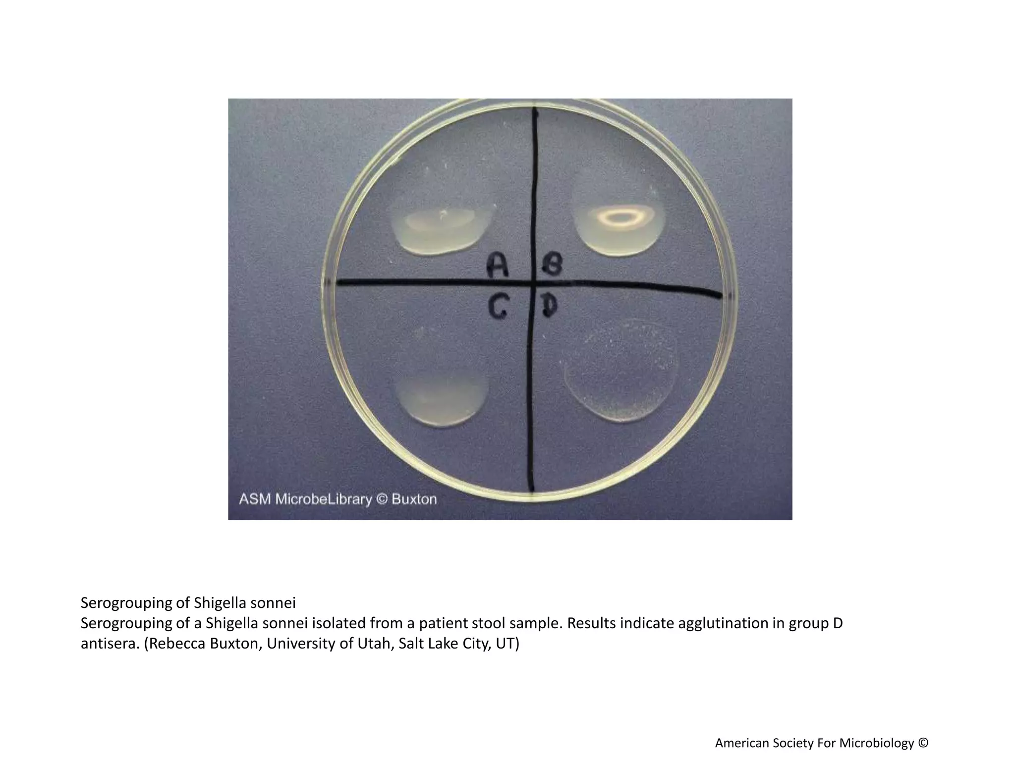 BACTERIAL-AGGLUTINATION.pptx