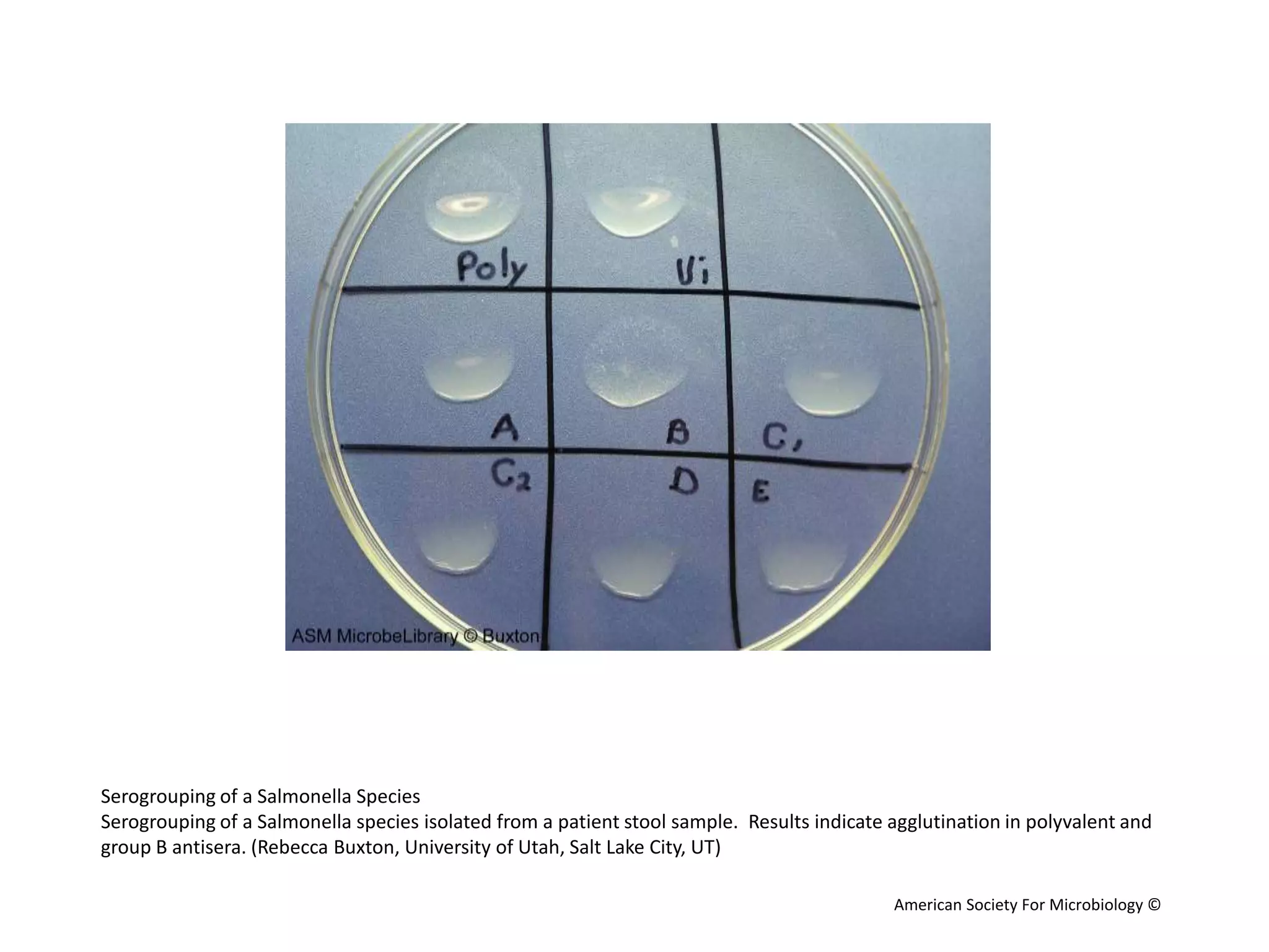 BACTERIAL-AGGLUTINATION.pptx
