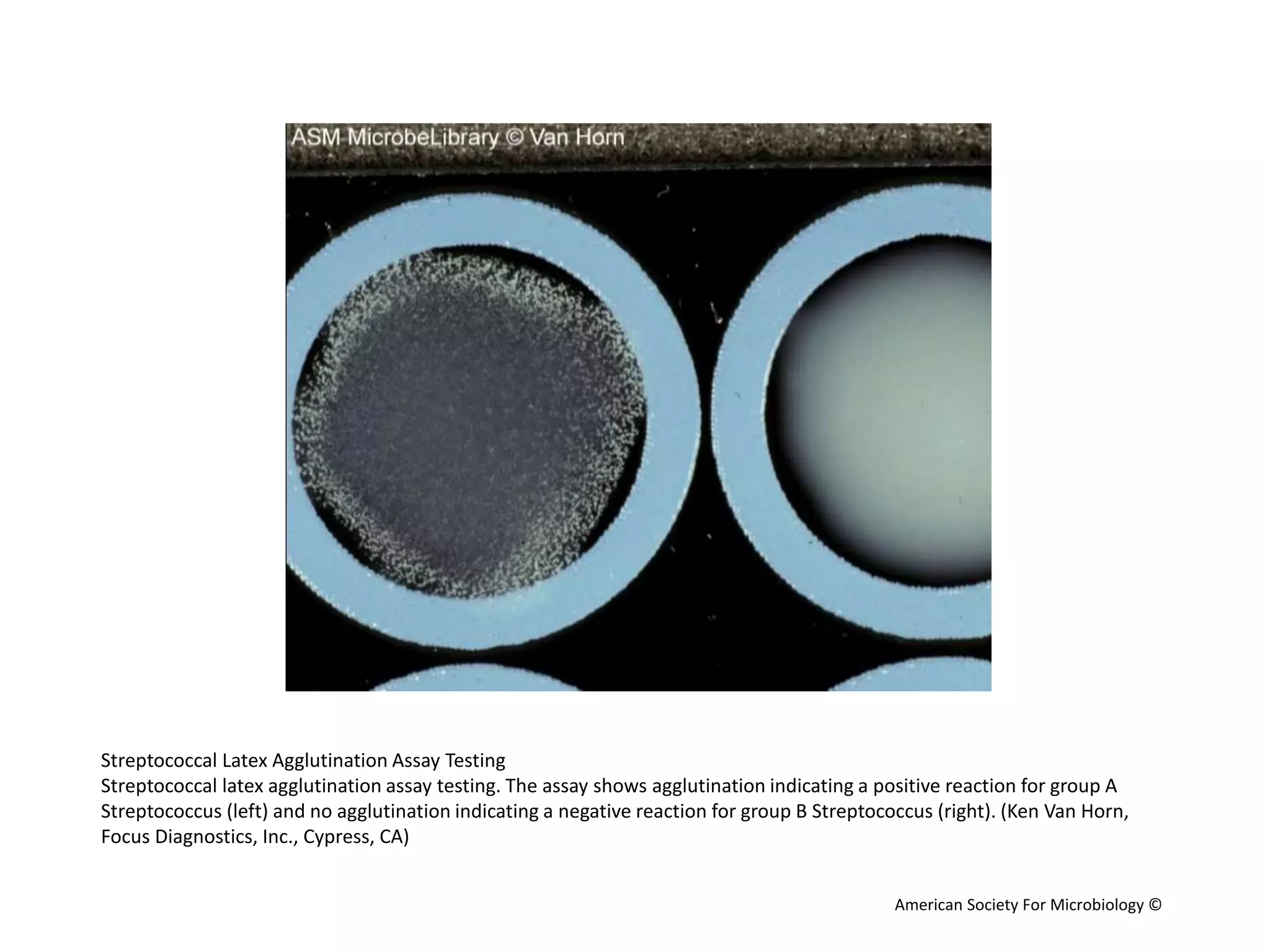 BACTERIAL-AGGLUTINATION.pptx
