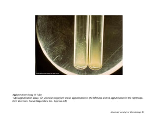 BACTERIAL-AGGLUTINATION.pptx