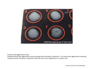 BACTERIAL-AGGLUTINATION.pptx