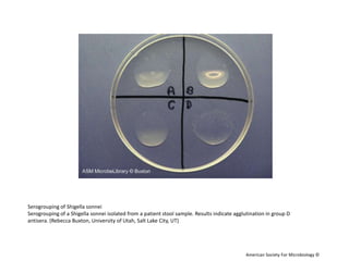 BACTERIAL-AGGLUTINATION.pptx