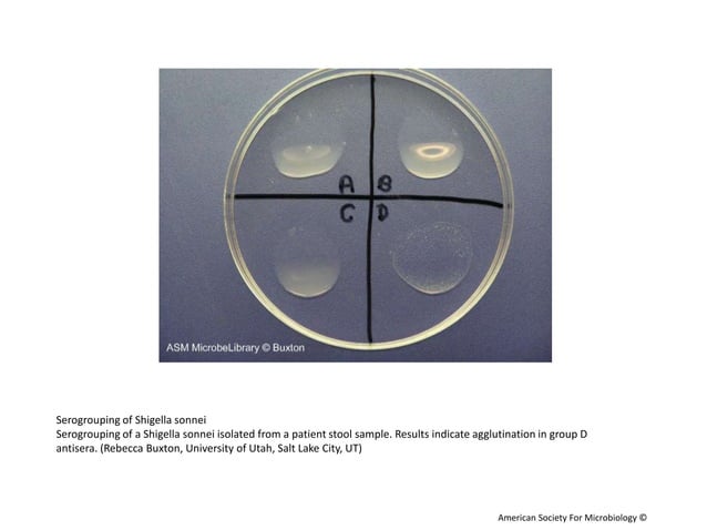 BACTERIAL-AGGLUTINATION.pptx | Chemistry | Science