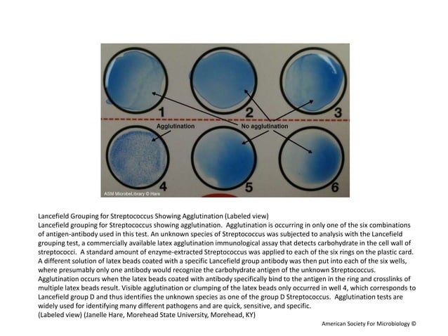 BACTERIAL-AGGLUTINATION.pptx | Chemistry | Science
