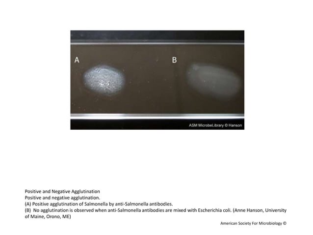 Bacterial Agglutination Pptx Chemistry Science