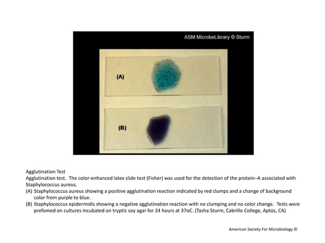 BACTERIAL-AGGLUTINATION.pptx | Chemistry | Science