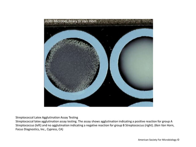 BACTERIAL-AGGLUTINATION.pptx | Chemistry | Science