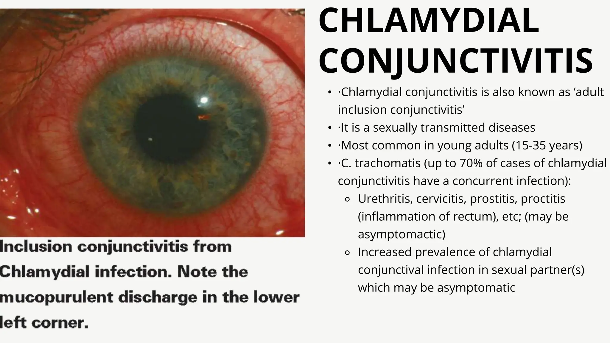 bacterial-infections eyes related infections | PPTX