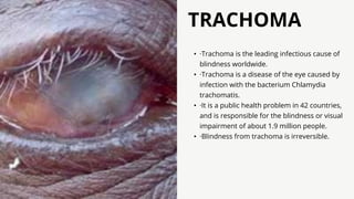 bacterial-infections eyes related infections | PPTX