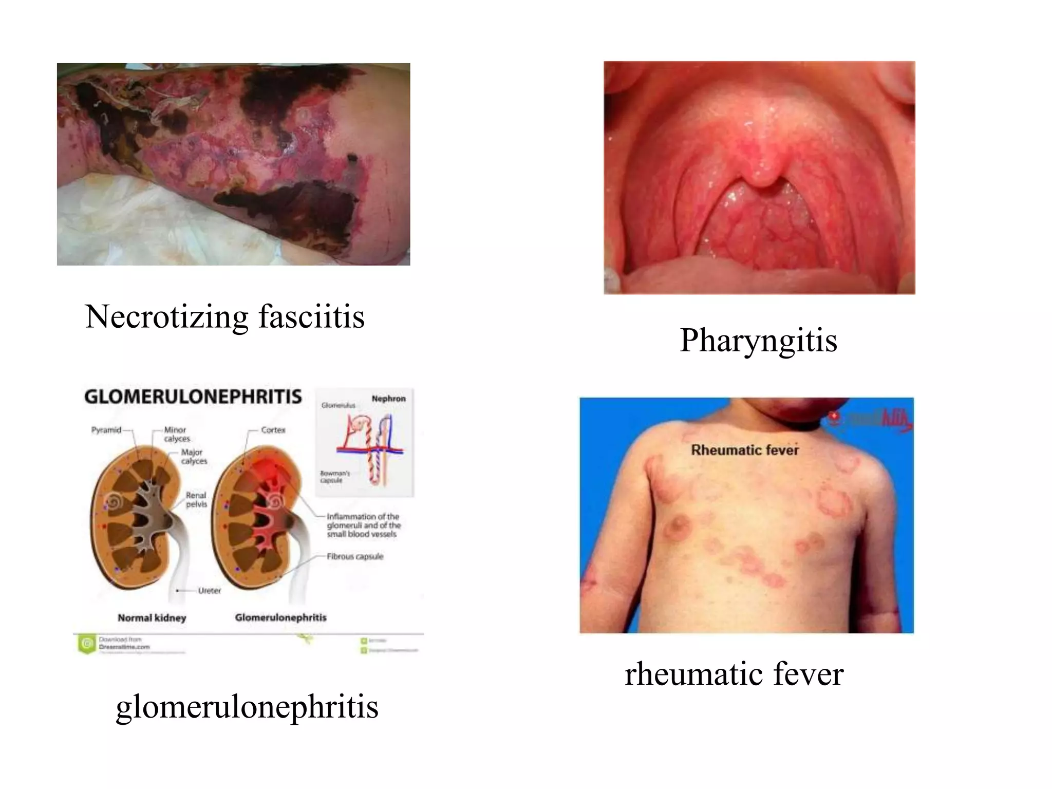 Bacterial Gram Positive Cocci Ppt