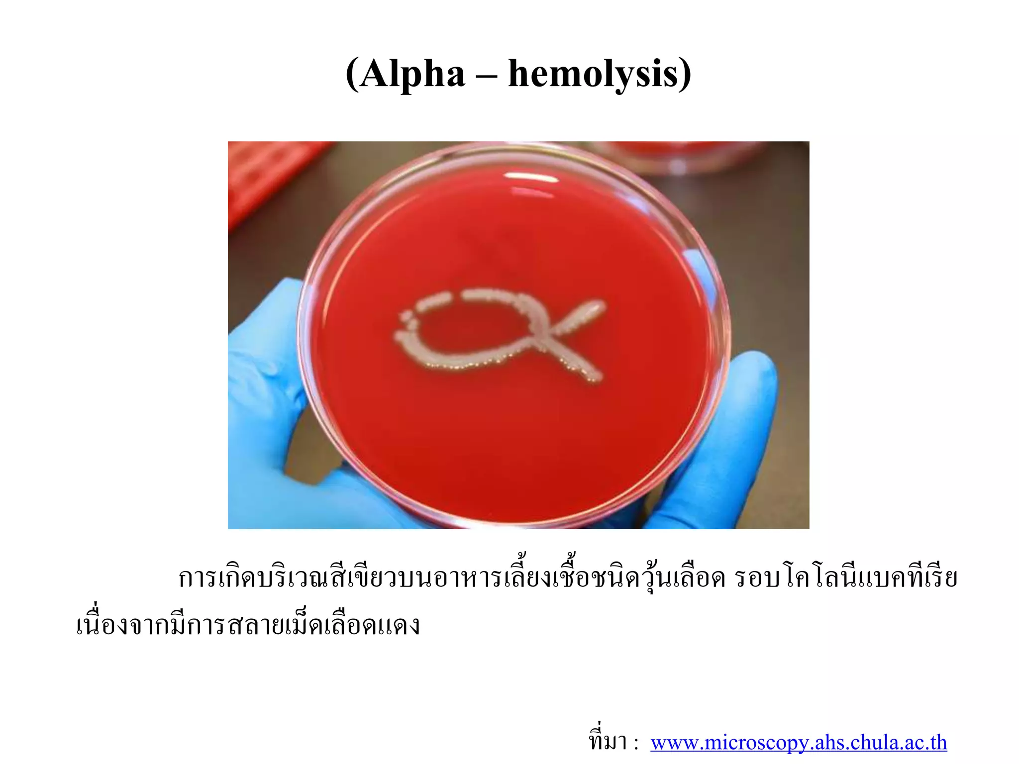 Bacterial Gram Positive Cocci Ppt