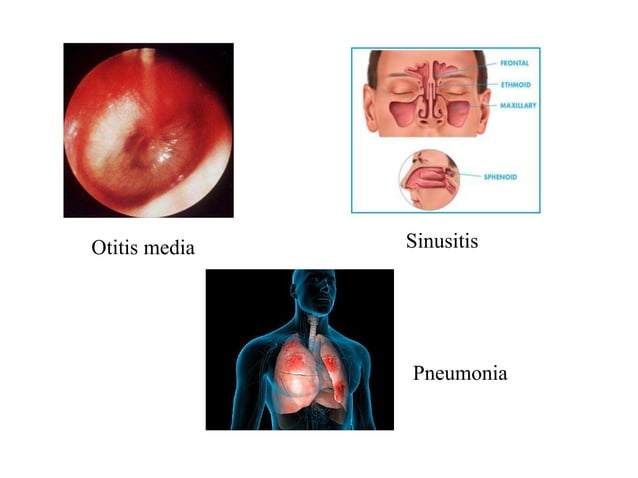 Bacterial Gram Positive Cocci Ppt