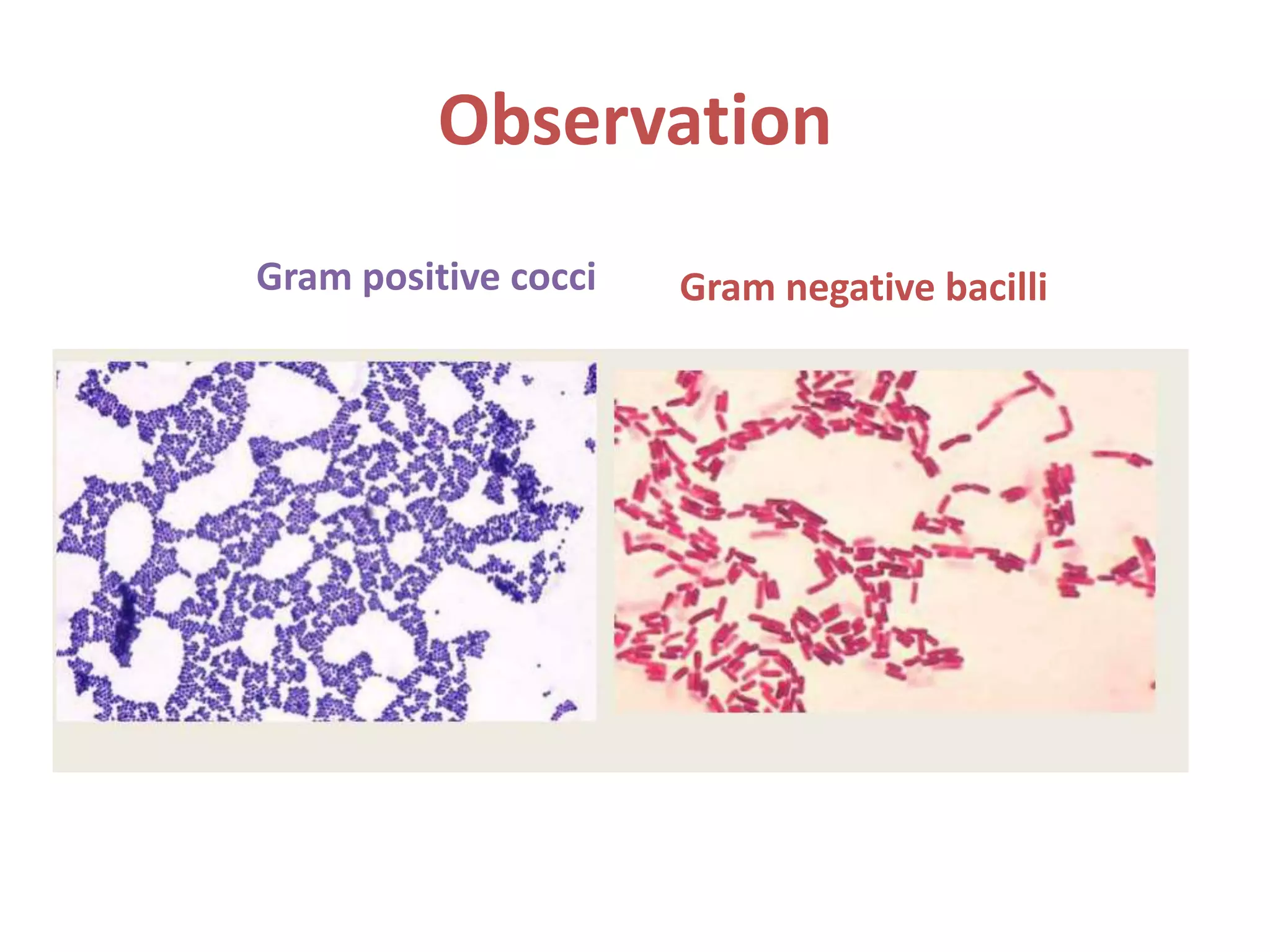Bacterial Staining Pptx