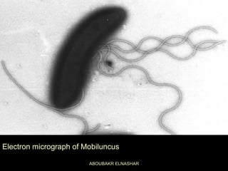 Bacterial vaginosis | PDF