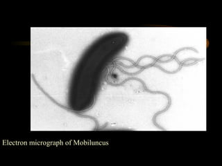 bacterial vaginosis | PPT