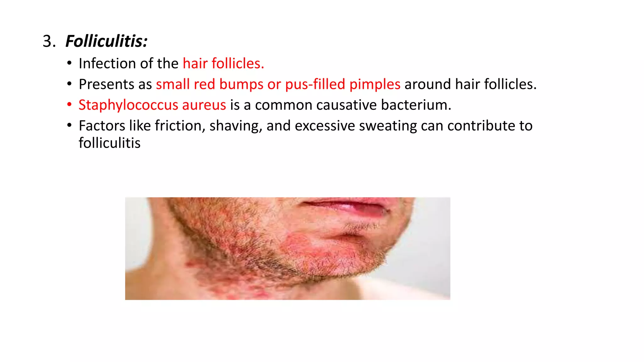 Bacterial and Fungal Skin Diseases.pptx