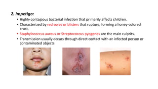 Bacterial and Fungal Skin Diseases.pptx