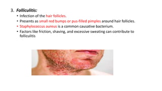 Bacterial and Fungal Skin Diseases.pptx