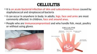 bacterial and viral skin infections - ppt | PPTX