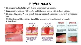 bacterial and viral skin infections - ppt | PPTX