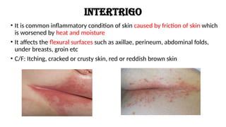 bacterial and viral skin infections - ppt | PPTX