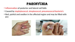 bacterial and viral skin infections - ppt | PPTX