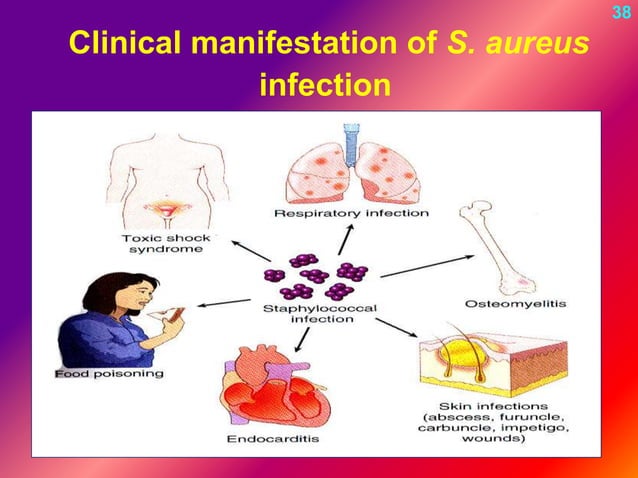 Bacterial animation and management | PPTX | Infectious Diseases ...