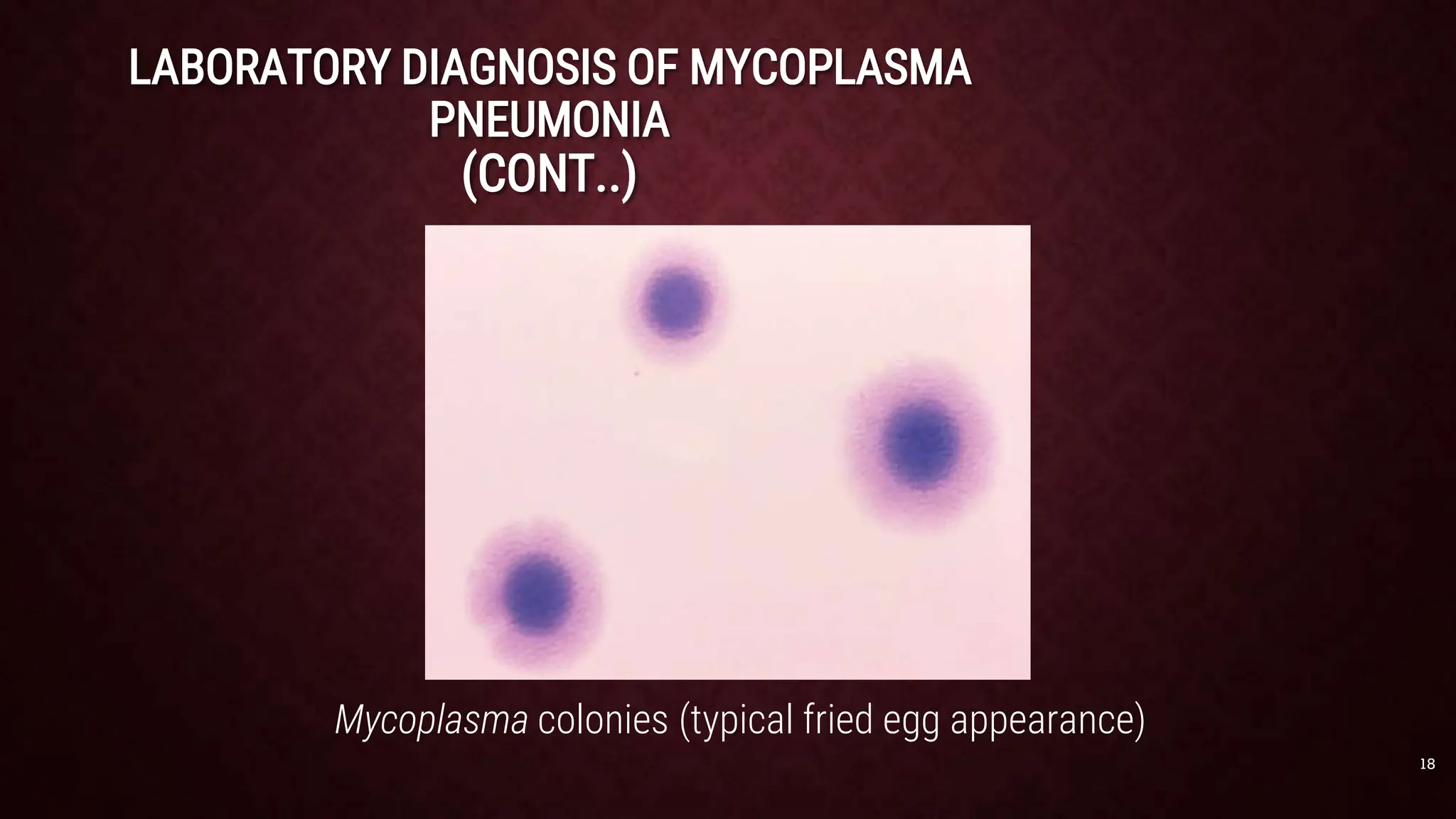 Bacterial Atypical pneumonia and its microbiological a[sectspptx | PPTX