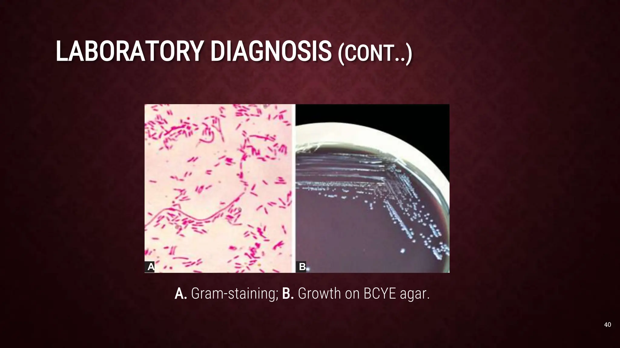 Bacterial Atypical pneumonia and its microbiological a[sectspptx | PPTX