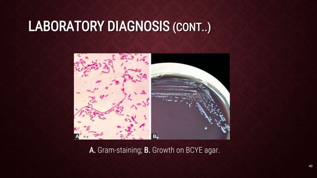 Bacterial Atypical pneumonia and its microbiological a[sectspptx | PPTX