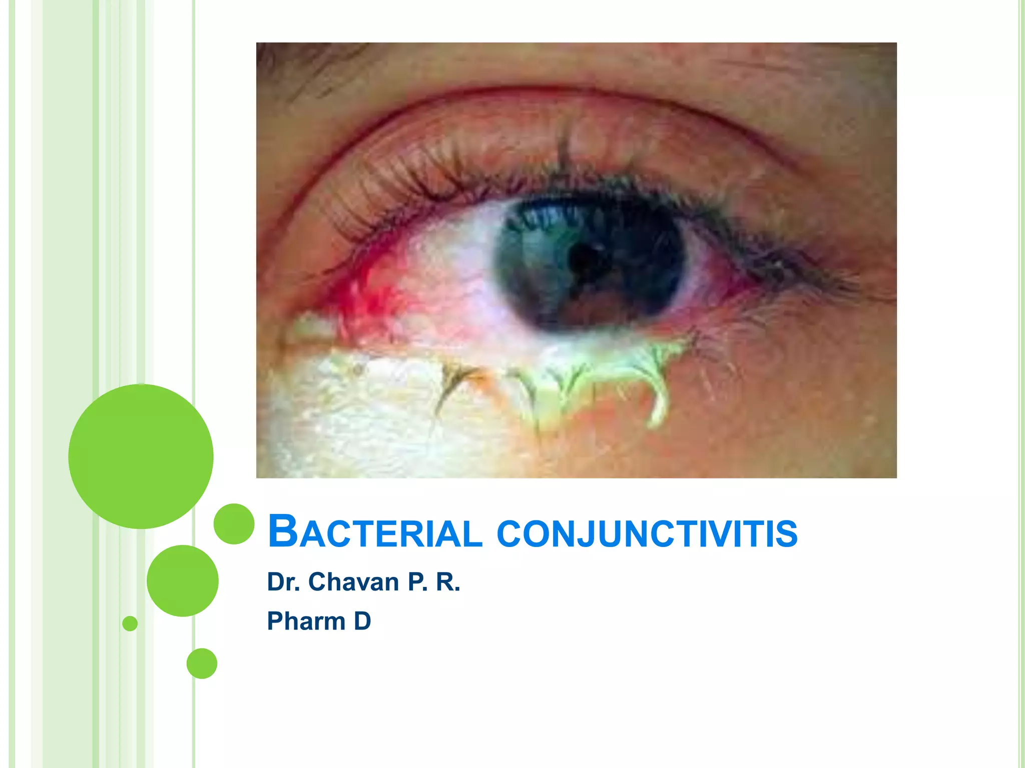 Bacterial conjunctivitis Pharmacotherapy | PPTX | Eye and Vision ...