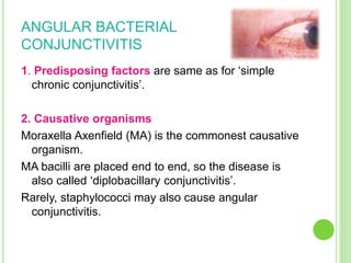 Angular Conjunctivitis