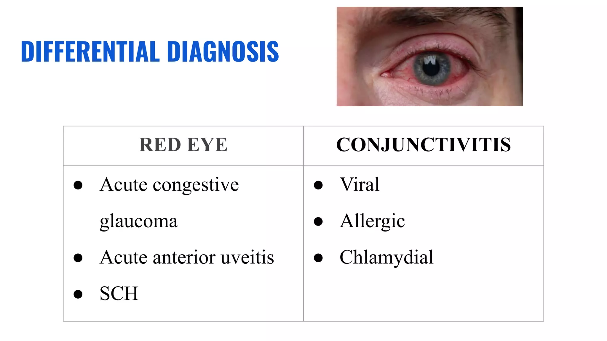 Bacterial conjunctivitis Ophthalmology | PDF