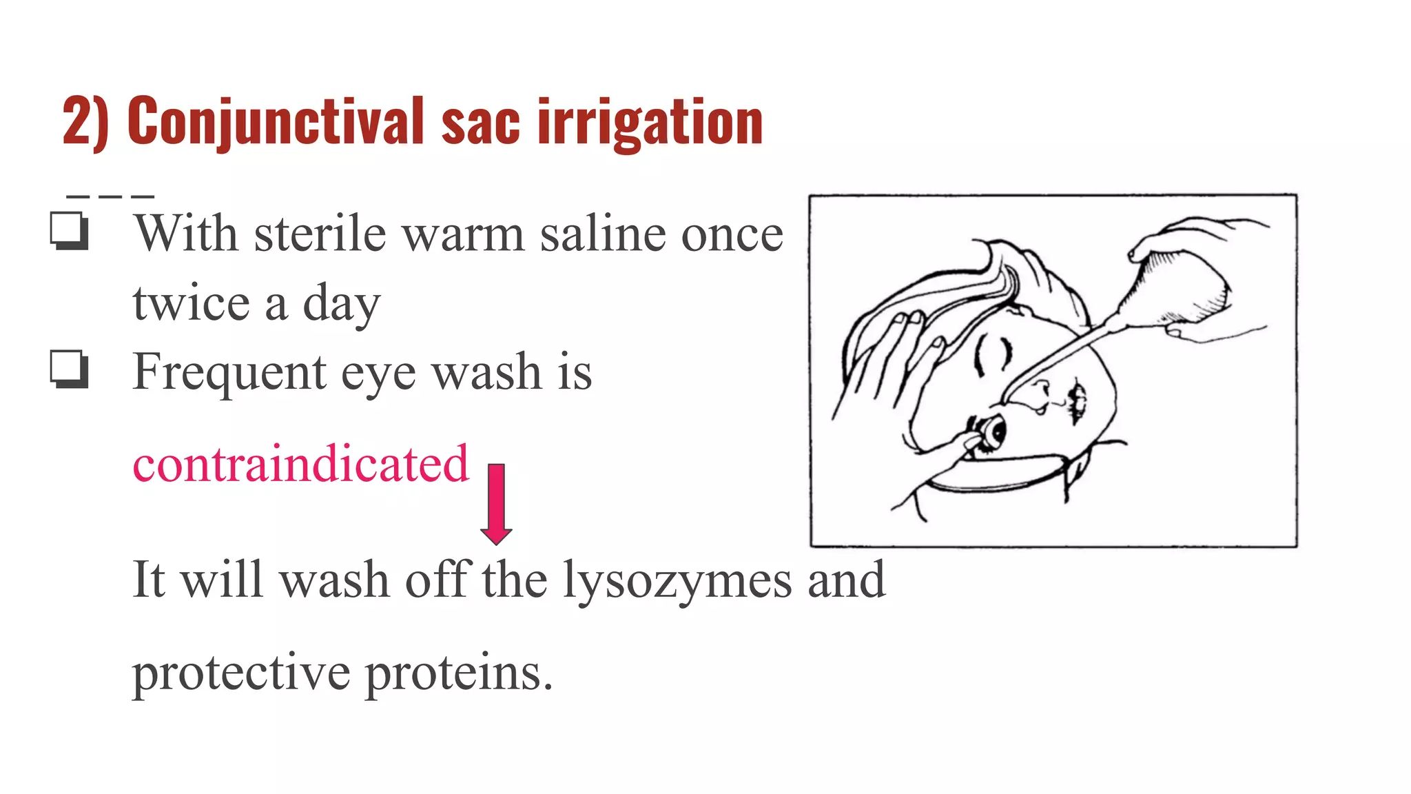 Bacterial conjunctivitis Ophthalmology | PDF