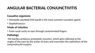 bacterial conjunctivitis.pptx jjjjjjjjjjjjjjjjjjjjjjjjjjjjjjjjjjjjjjj | PPTX