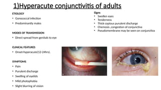 bacterial conjunctivitis.pptx jjjjjjjjjjjjjjjjjjjjjjjjjjjjjjjjjjjjjjj | PPT