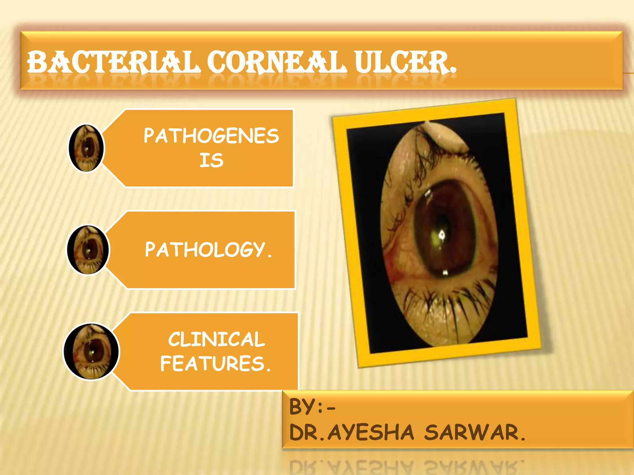 Bacterial corneal ulcer (Etilogy, pathogenesis, pathology & clinical ...