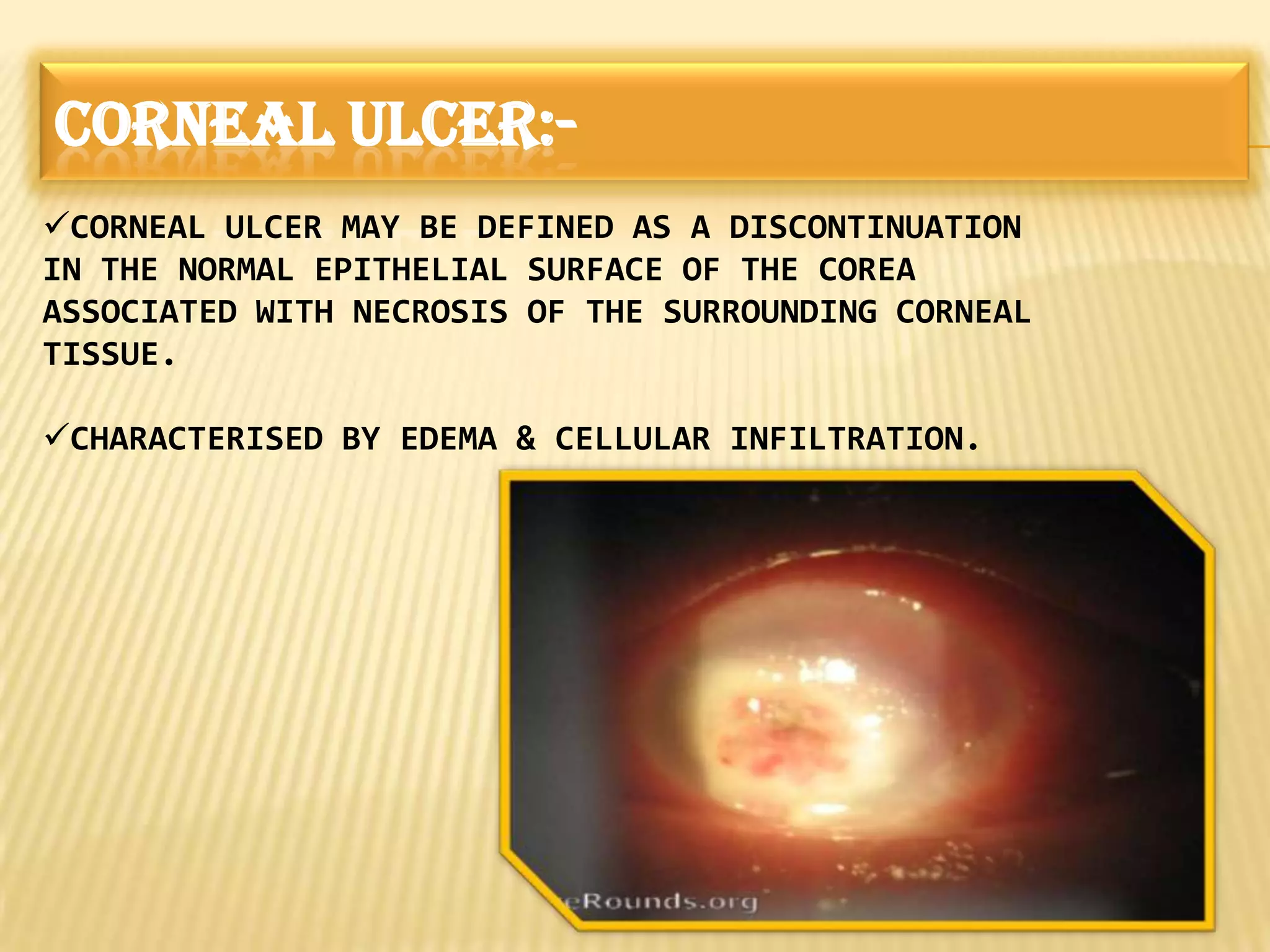Bacterial corneal ulcer (Etilogy, pathogenesis, pathology & clinical ...