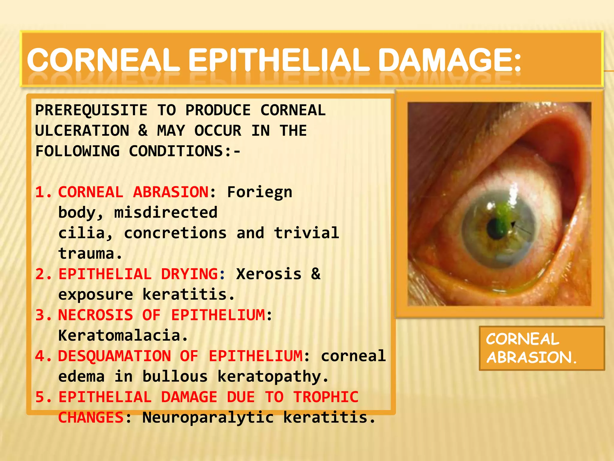 Bacterial corneal ulcer (Etilogy, pathogenesis, pathology & clinical ...