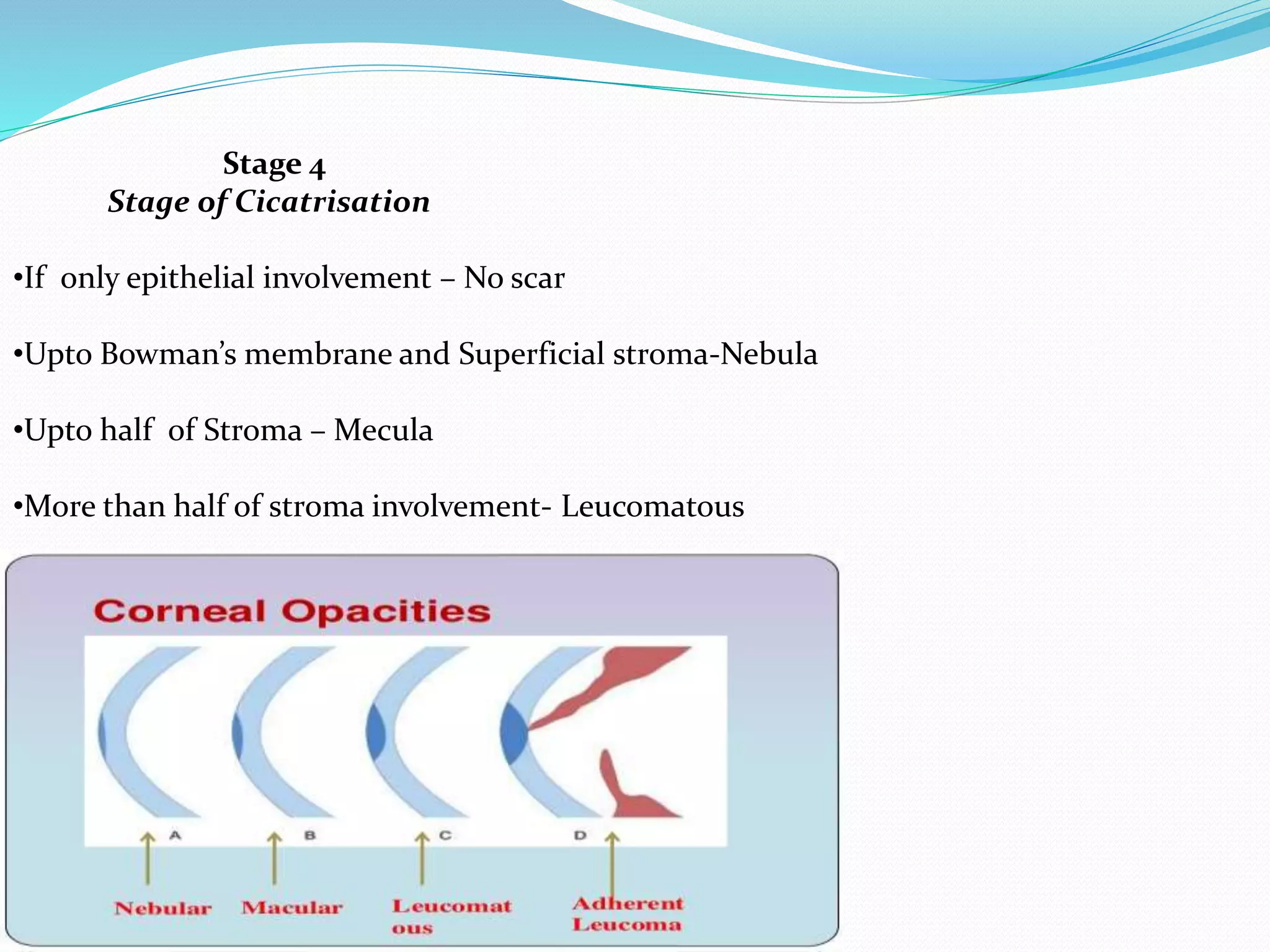Bacterial Corneal Ulcer Ppt